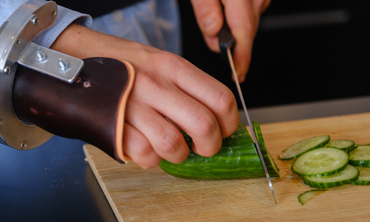 Vilje Bionics vil hjelpe millioner av mennesker - DNB Nyheter